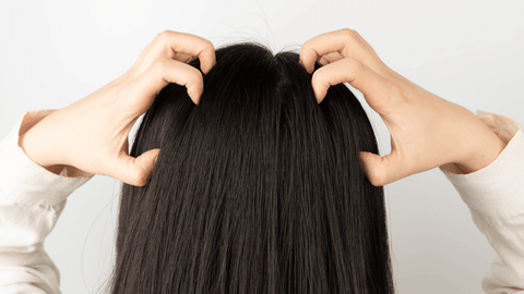 What is seborrheic dermatitis and why did it happen to me? – Biotrade